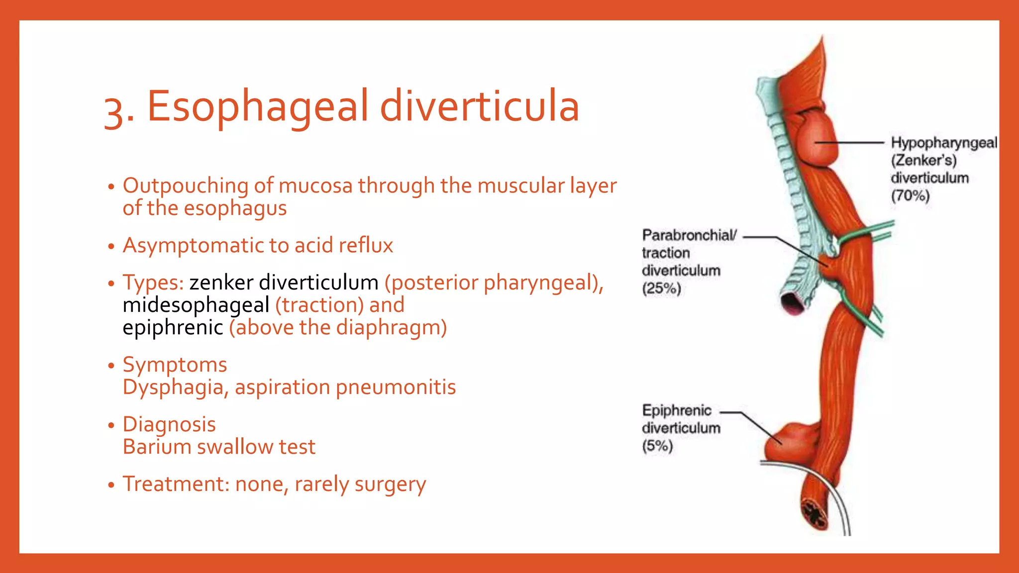 Esophageal diseases, Gastroesophageal reflux disease (GERD) | PPTX