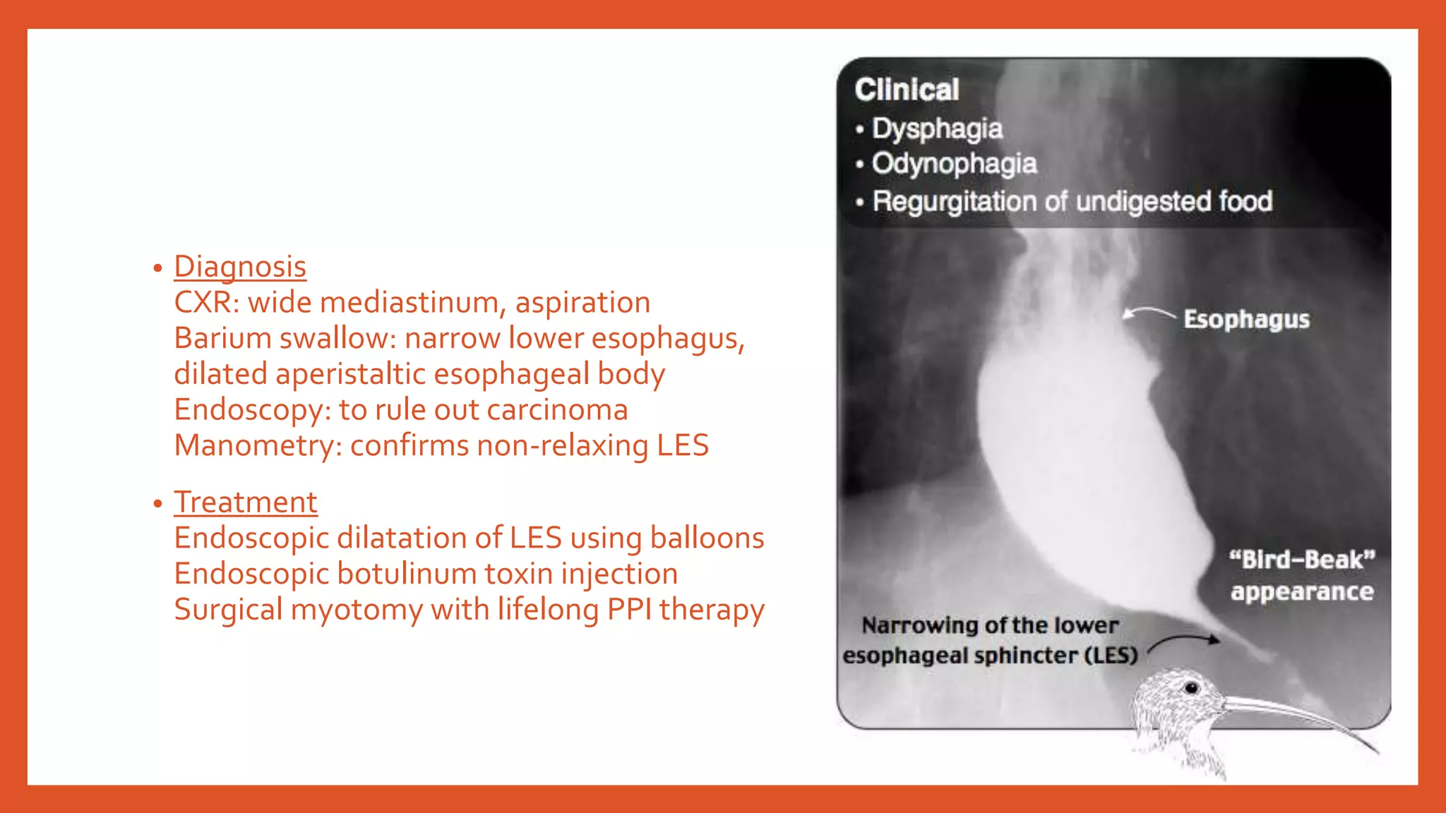Esophageal diseases, Gastroesophageal reflux disease (GERD) | PPTX