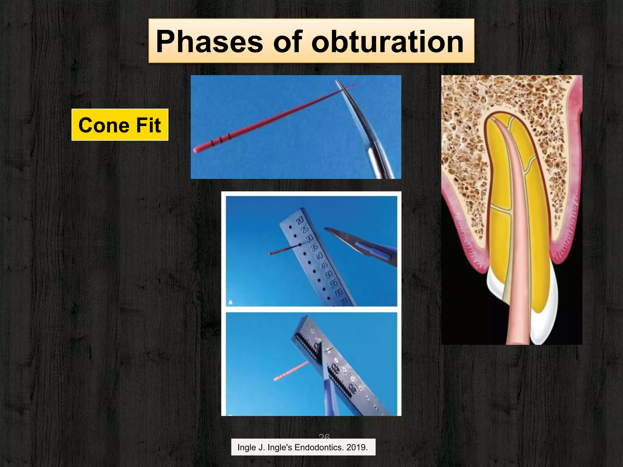 TECHNIQUES OF OBTURATION | PPTX