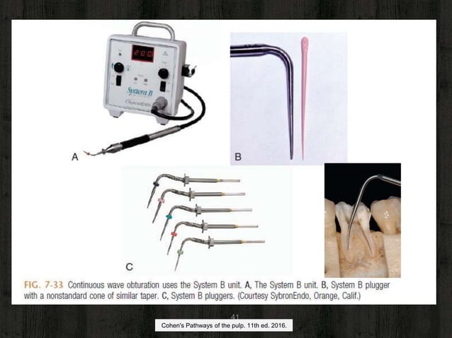 TECHNIQUES OF OBTURATION | PPTX