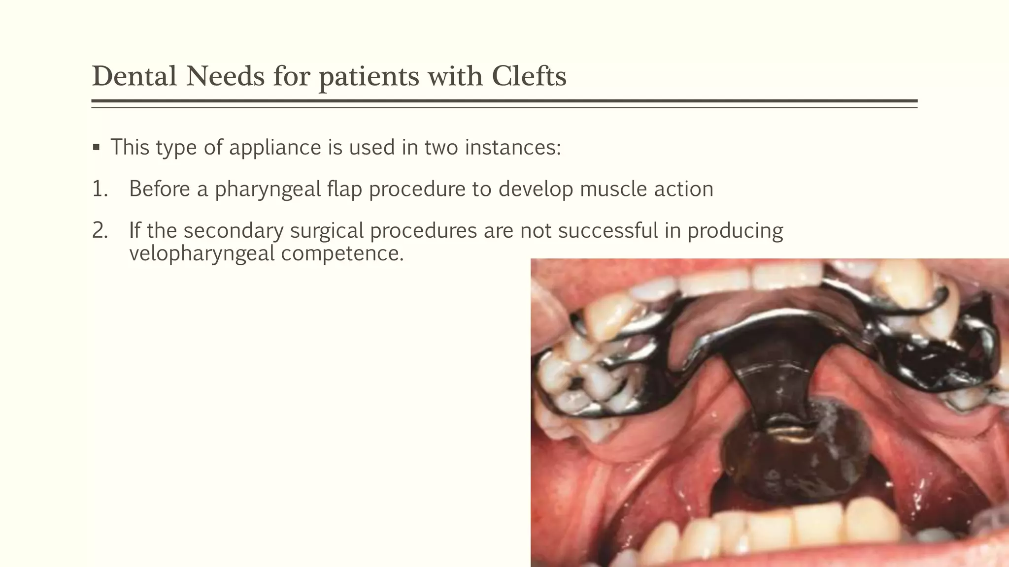 Cleft Lip and Palate | PPTX