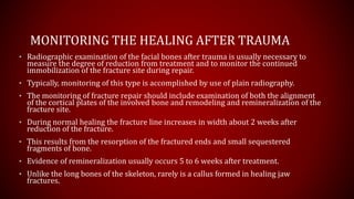Radiographic Features of Head and Neck Trauma | PPTX