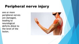 29. Peripheral nerve injury.pptx
