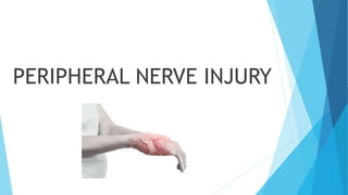 29. Peripheral nerve injury.pptx