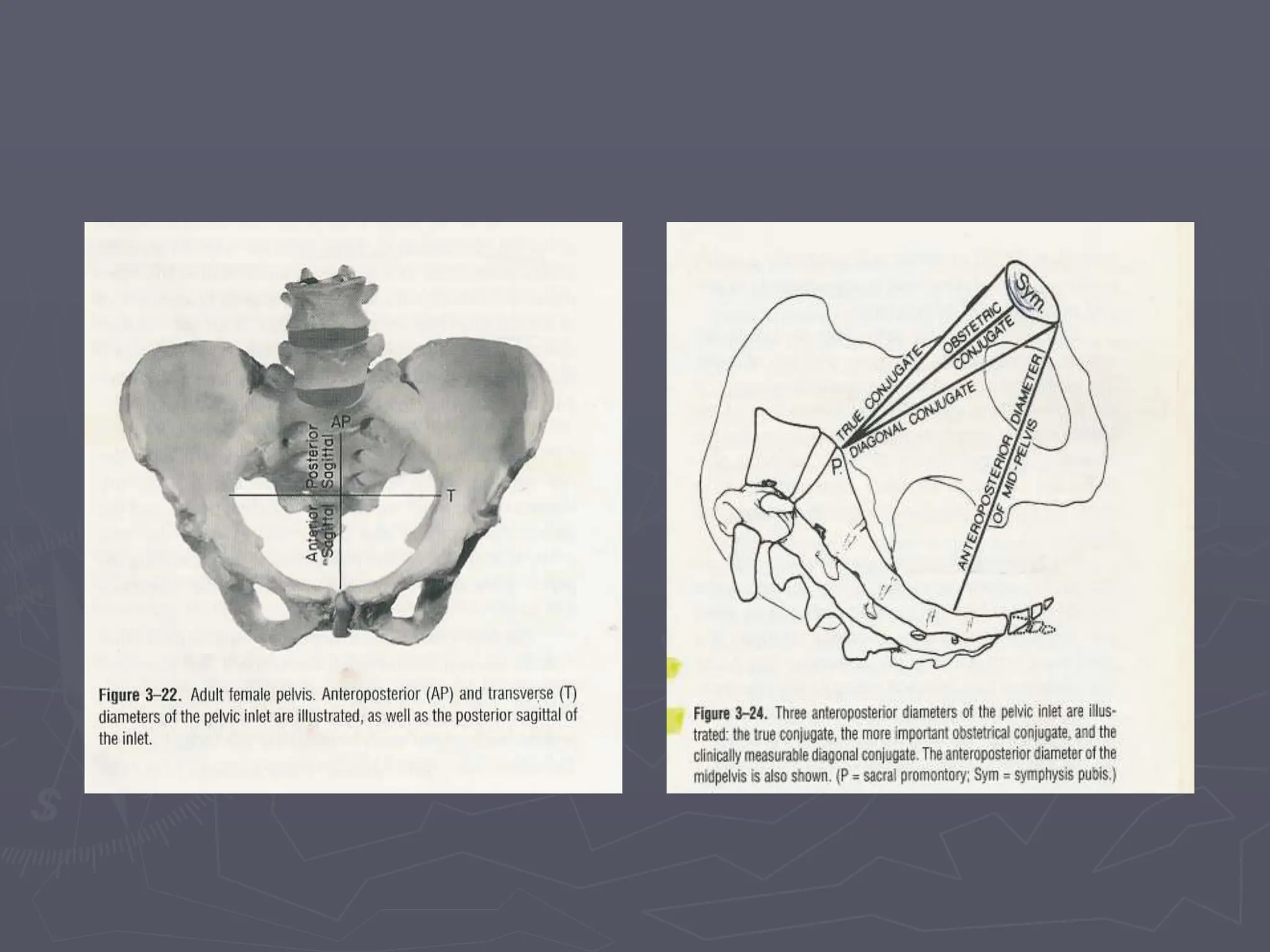 Anatomy of the bony pelvis With all types | PPT