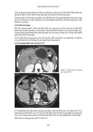 Nang giả tuỵ | PDF