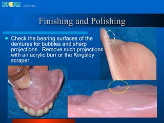 29.preparing dentures for delivery | PPT