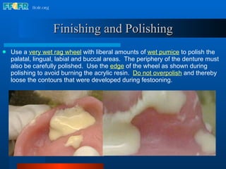 29.preparing dentures for delivery | PPT