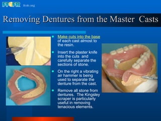 29.preparing dentures for delivery | PPT