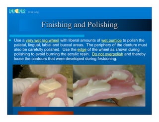 29.preparing dentures for delivery | PDF