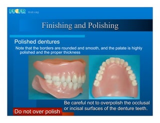 29.preparing dentures for delivery | PDF