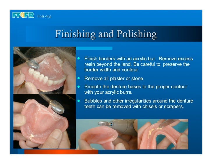 29.preparing dentures for delivery