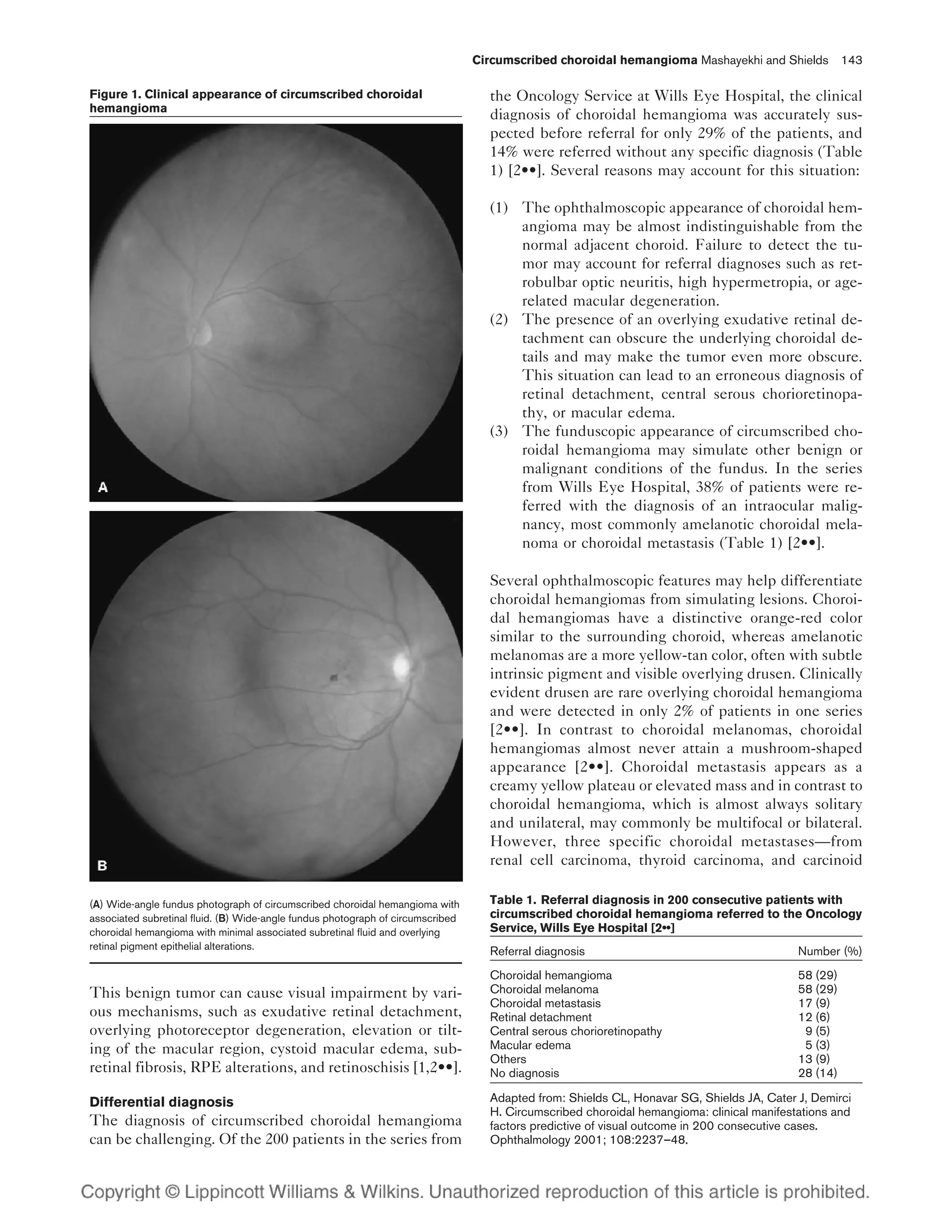 Circumscribed choroidal hemangioma | PDF