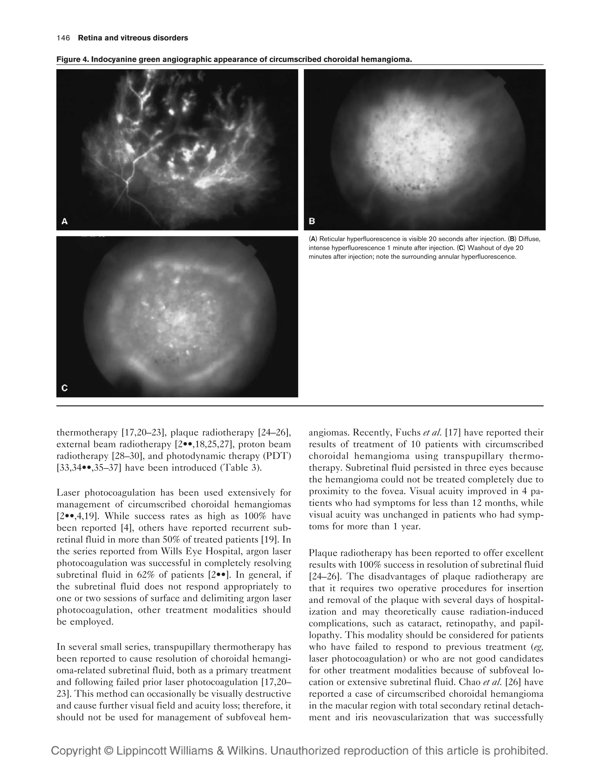 Circumscribed choroidal hemangioma | PDF