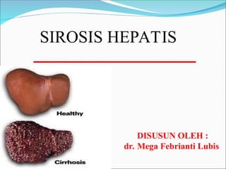 Tatalaksana sirosis hati secara umum.ppt