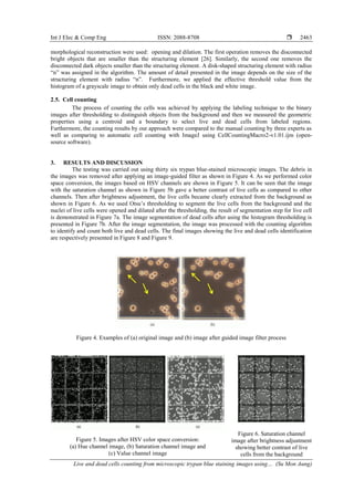 Live and Dead Cells Counting from Microscopic Trypan Blue Staining Images using Thresholding and ...