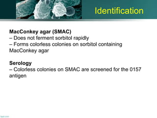 acinobacter & ecoli | PPT