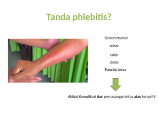 POWER POINT PHLEBITIS EDUKASI DAN TANDA PHLEBITIS | PPTX