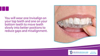The visible difference between invisalign and braces | PPT