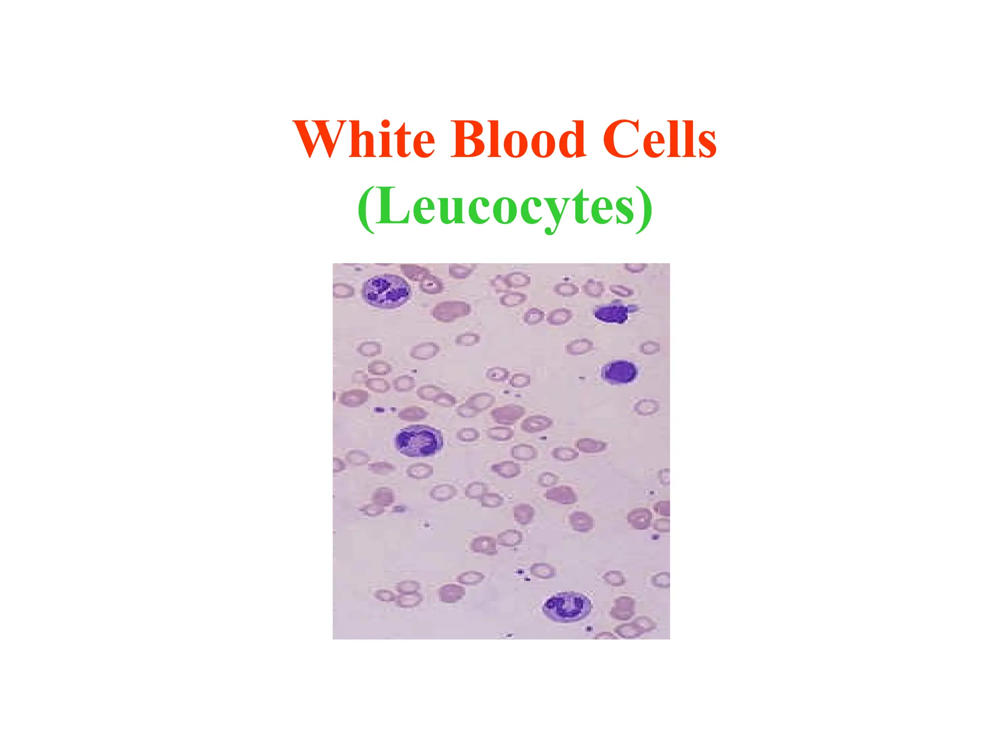 29609_Blood module 5 WBC 08.ppt blood dis | PPT