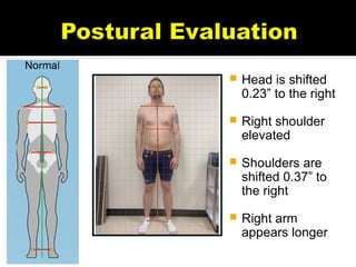 posture | PPT | Physical Therapy | Wellness