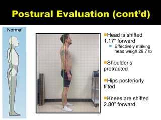 posture | PPT | Physical Therapy | Wellness