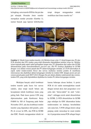 298899-jones-tendon-transfer-modification-with-dfa2d5a8.pdf