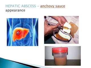 Entamoeba Histolytica Anchovy Paste