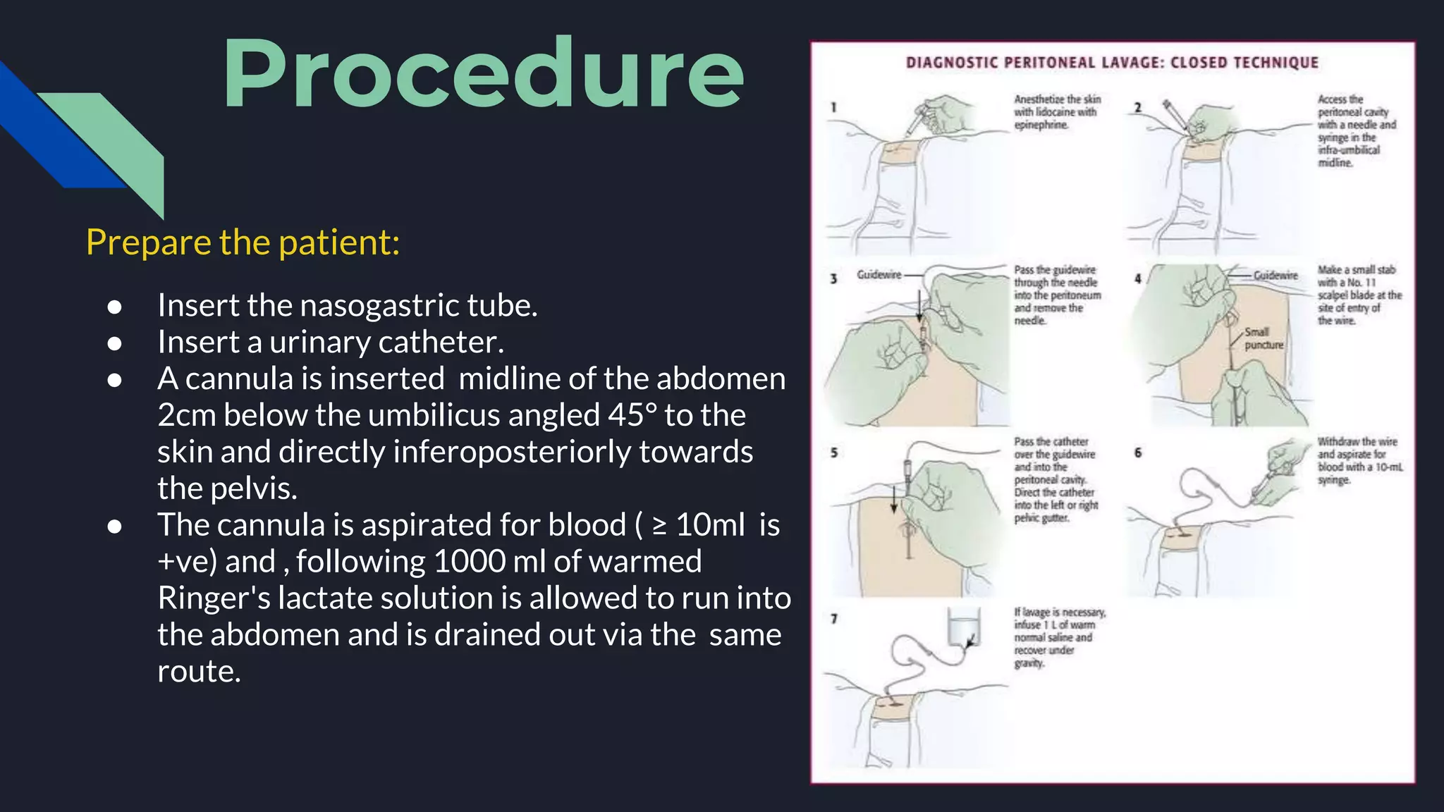 diagnostic peritoneal lavage (DPL) | PPTX