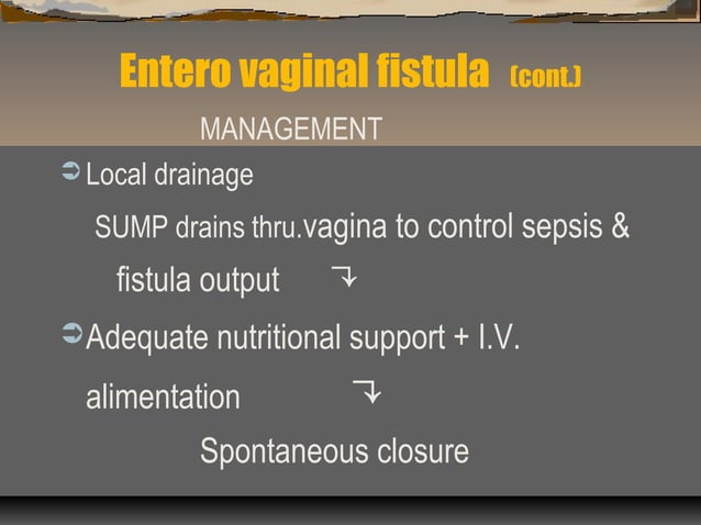 internal fistula of bowel | PPT