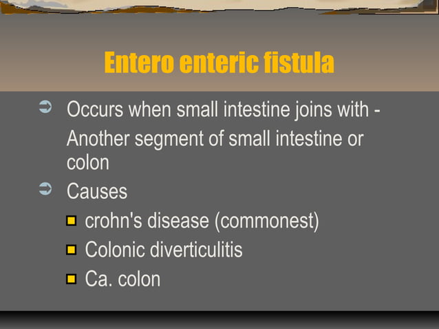 internal fistula of bowel | PPT