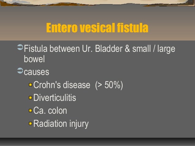internal fistula of bowel