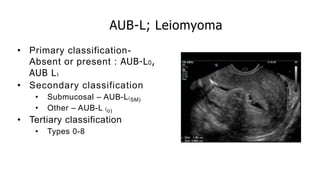 AUB Diagnosis and evaluation BY: Dr. DIPTI NABH Dr Sharda Jain | PPTX