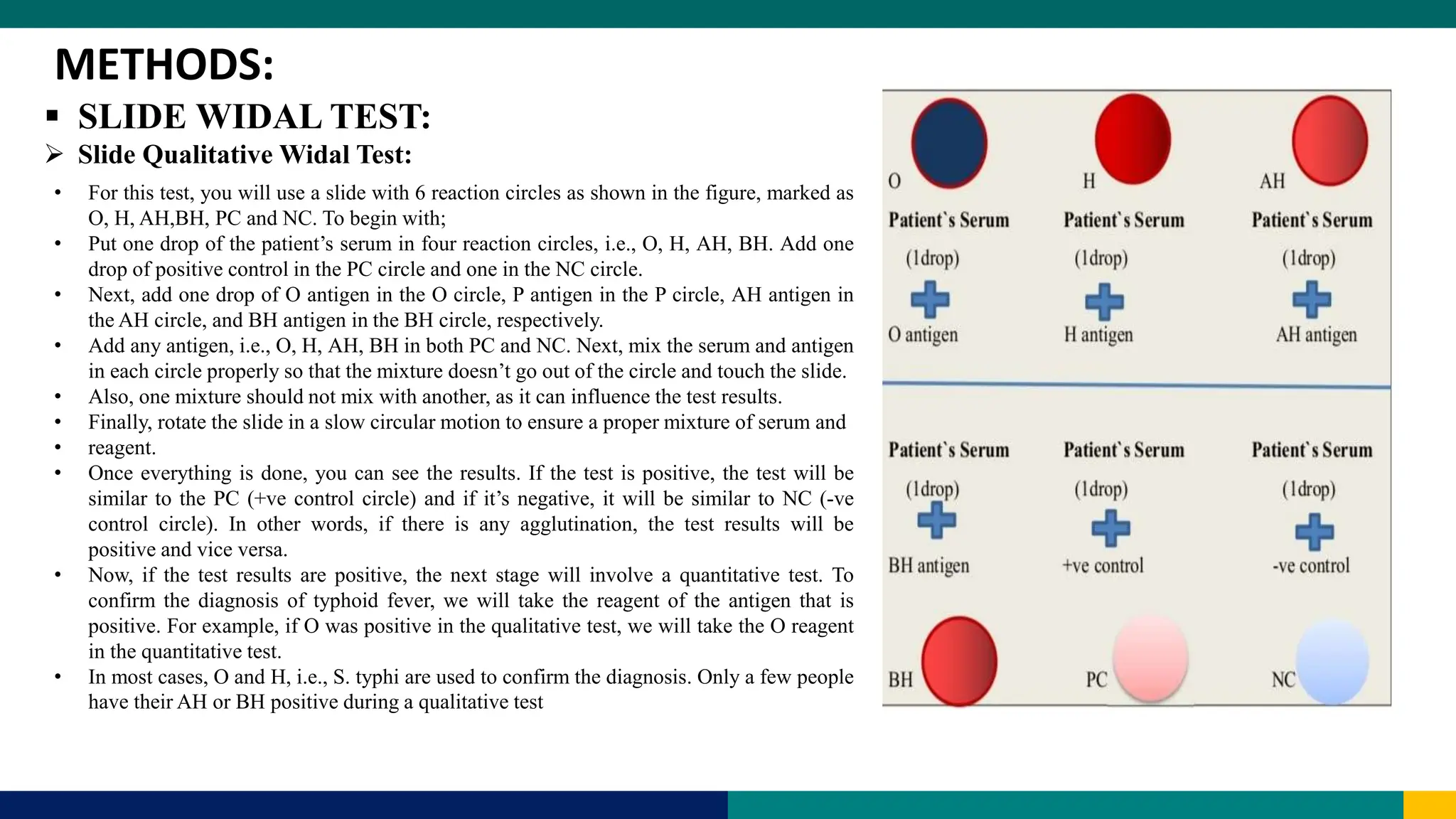 Widal Agglutination Test: A rapid serological diagnosis of typhoid ...