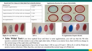 Widal Agglutination Test: A rapid serological diagnosis of typhoid ...