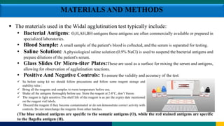 Widal Agglutination Test: A rapid serological diagnosis of typhoid ...