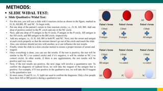 Widal Agglutination Test: A rapid serological diagnosis of typhoid ...