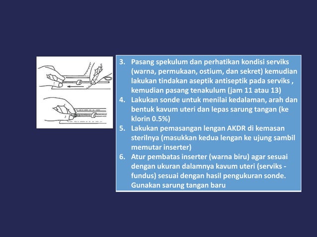 2a. Alat Kontrasepsi Dalam Rahim AKDR.pptx