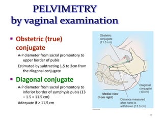 2 Abdomen and Pelvis.pptx111111111111111111111111 | PPT