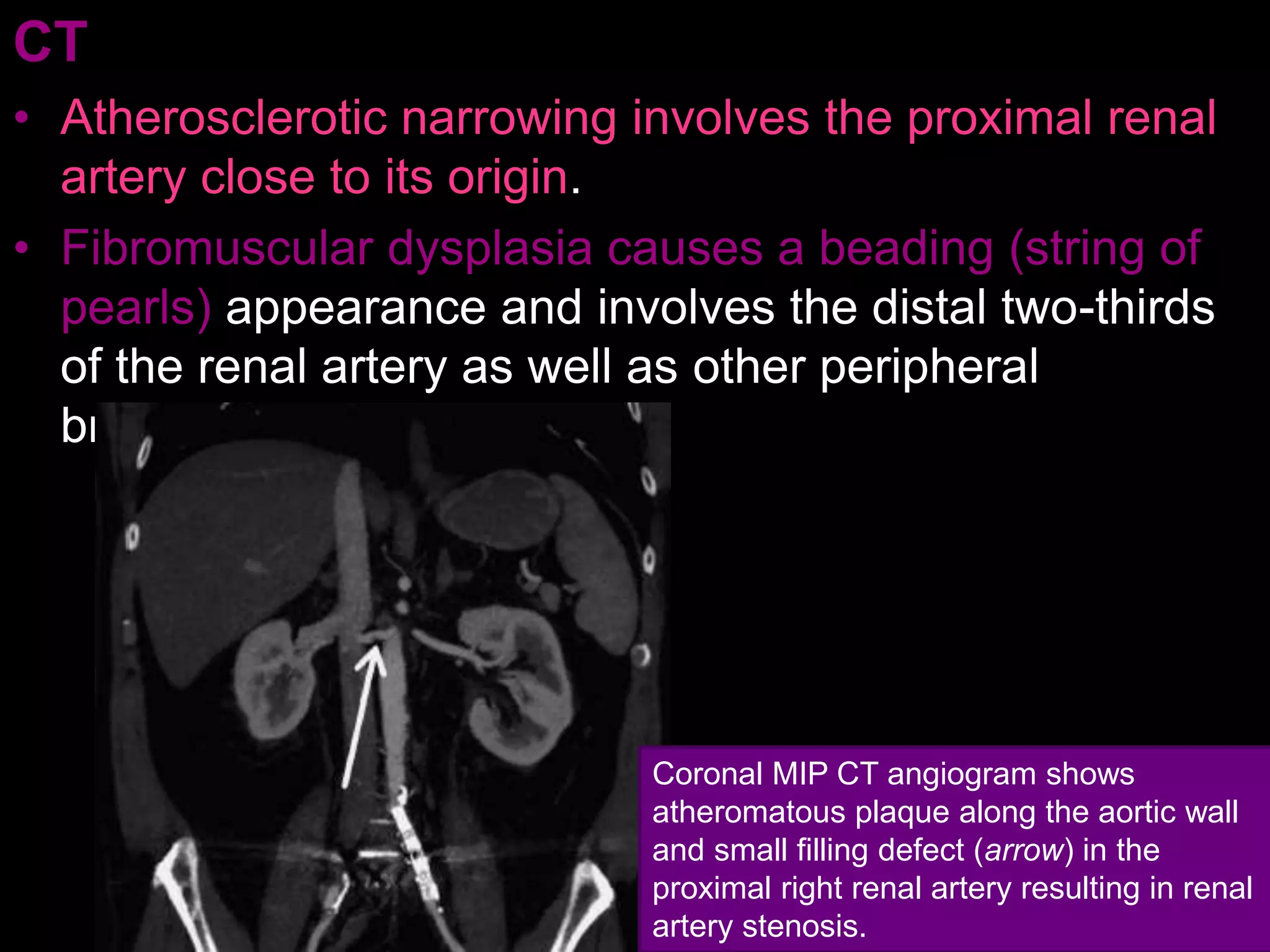 2 abdomen pathology ct | PPTX