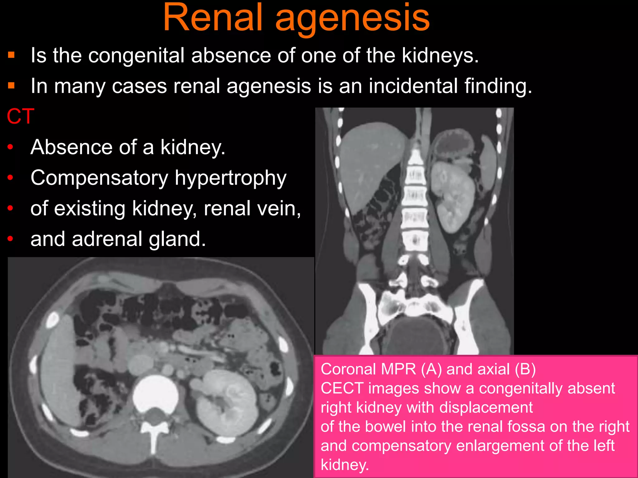 2 abdomen pathology ct | PPTX