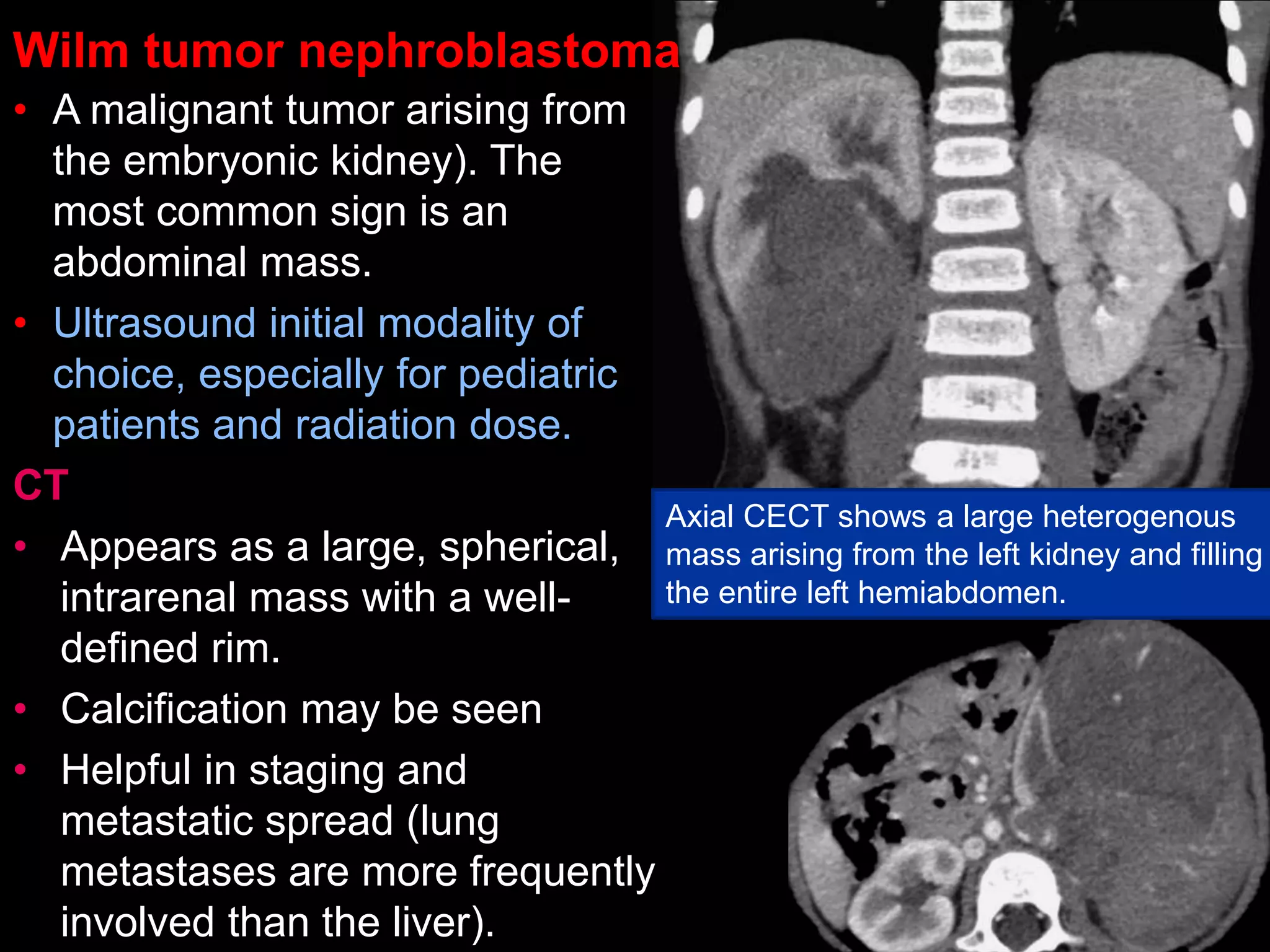 2 abdomen pathology ct | PPTX