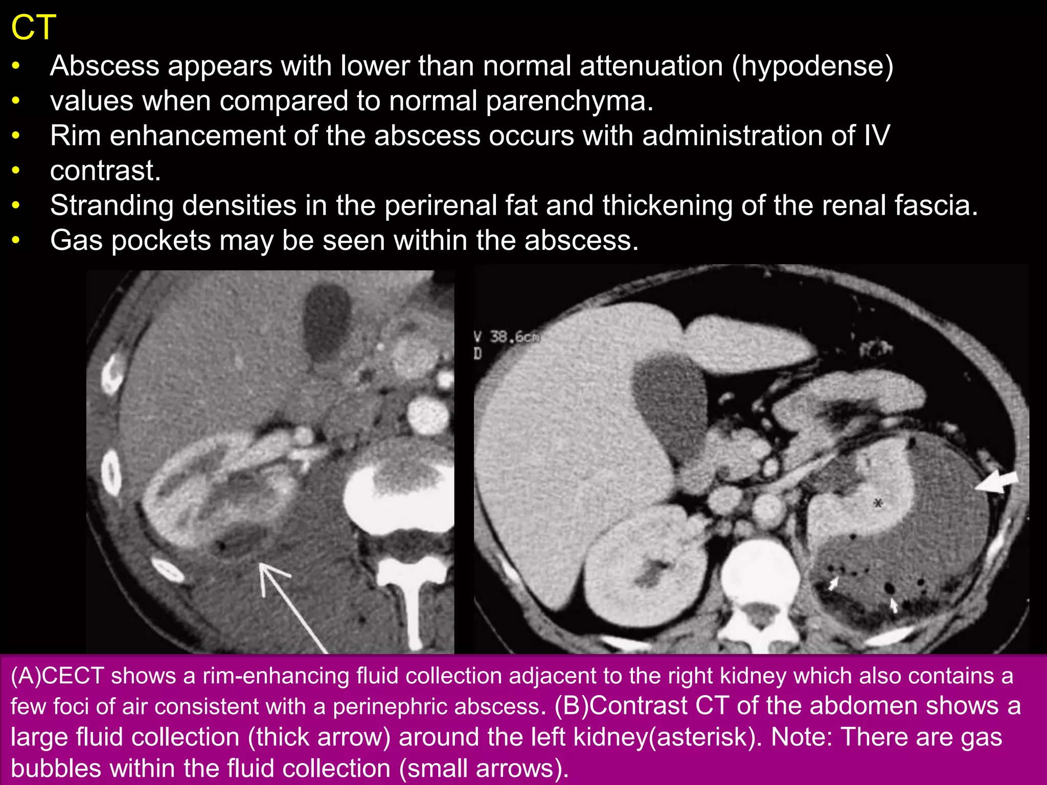 2 abdomen pathology ct | PPTX