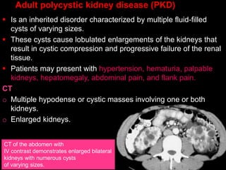 2 abdomen pathology ct | PPTX