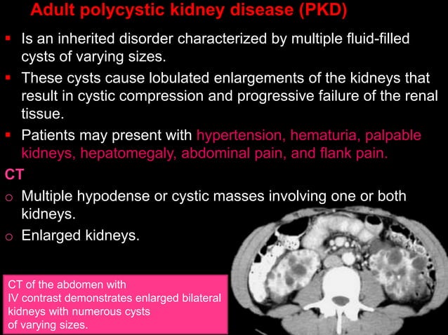 2 abdomen pathology ct | PPTX