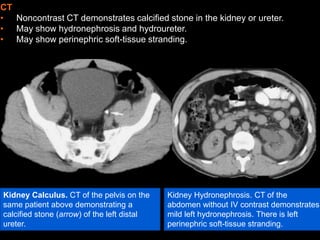 2 abdomen pathology ct | PPTX