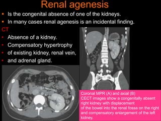 2 abdomen pathology ct | PPTX