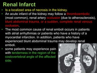 2 abdomen pathology ct | PPTX