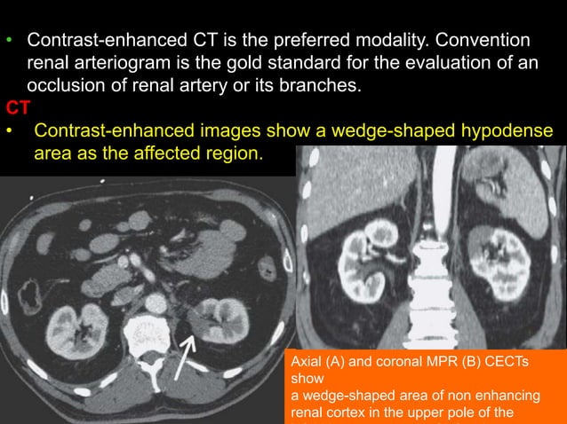 2 abdomen pathology ct | PPTX