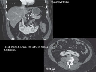 2 abdomen pathology ct | PPTX